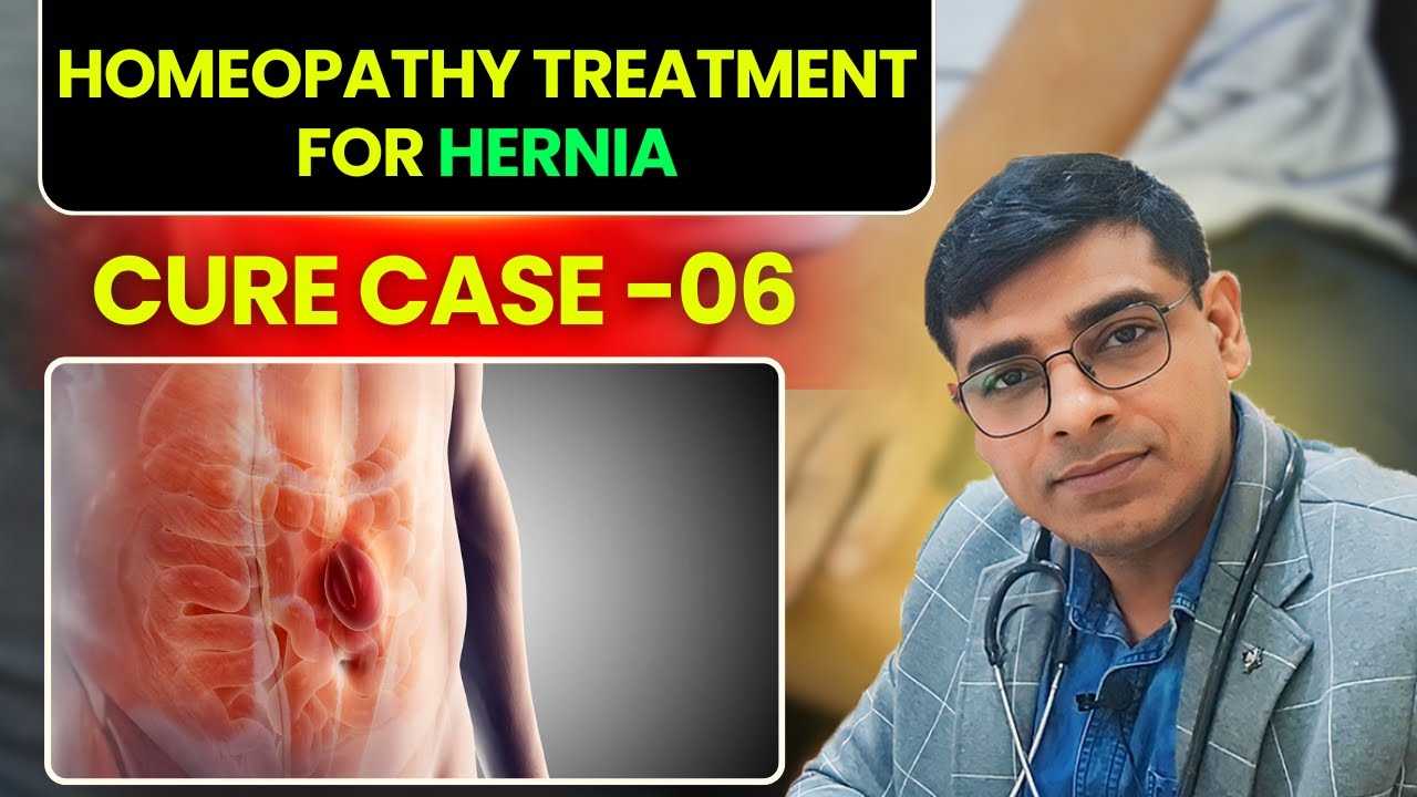 Hernia Cure Case No 6 | Homeopathy Treatment for Hernia | Dr Abhik ...