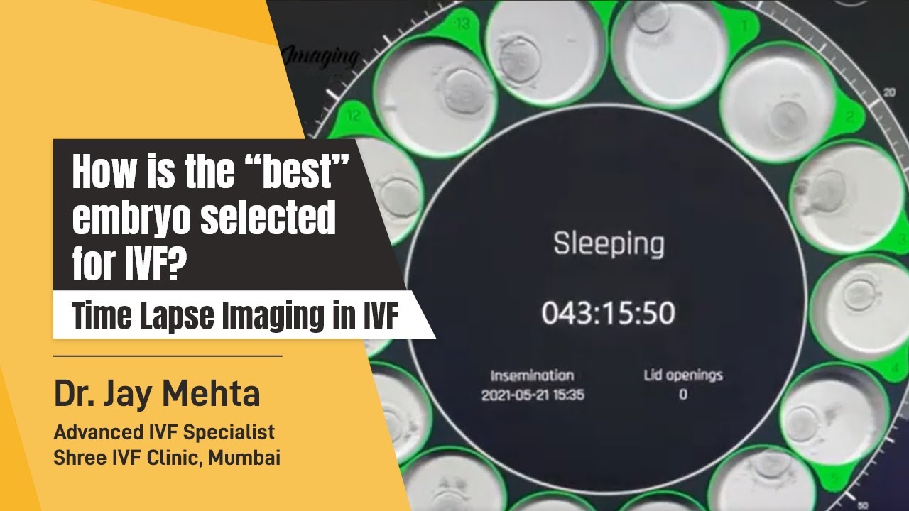 How is the “BEST” embryo selected for IVF? | Time Lapse Imaging in IVF ...