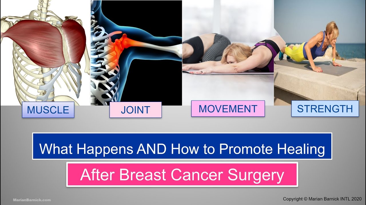 Promote Healing with Movement After Breast Cancer Surgery - YouTube