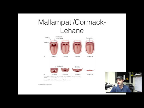 5 minute refresher- Difficult Airway Assessment - YouTube