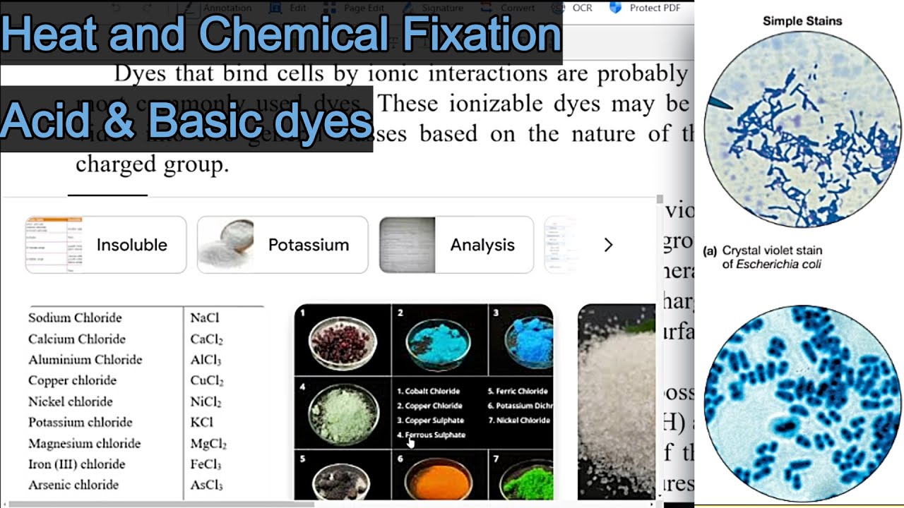 Stains and staining p1| acid stain & base stain| Study with me ...