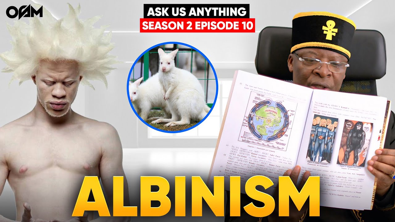 Albino - What is Albinism? - YouTube