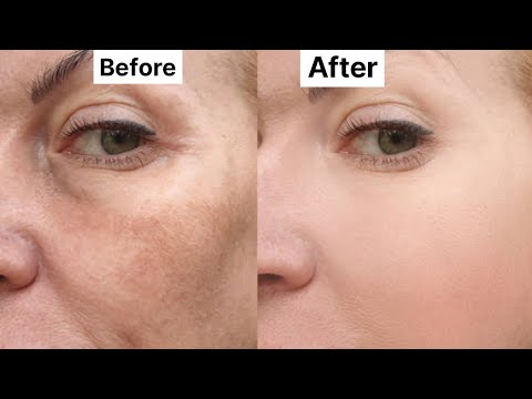 Face yoga is very important for all people between 20 to 50 years of ...