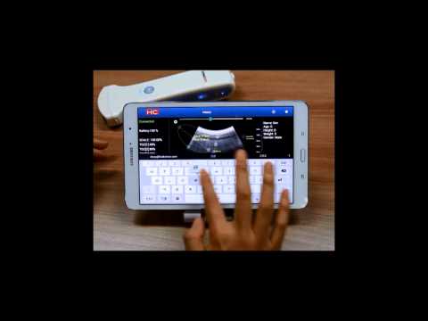 Sonon 300C : Tutorial - YouTube