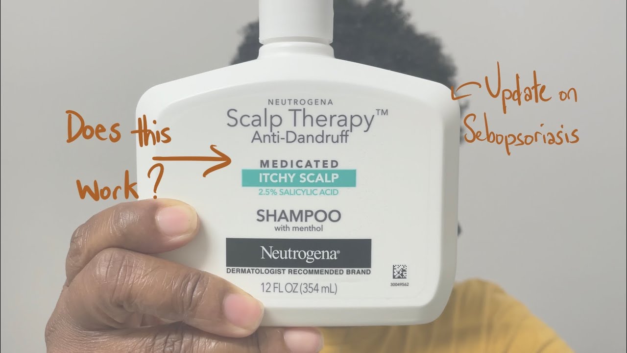 Sebopsoriasis Update | Using Neutrogena Scalp Therapy Anti-Dandruff and ...