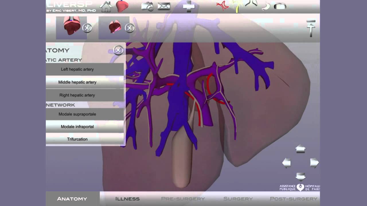 Liver Surgery Planner by SIGHT - YouTube