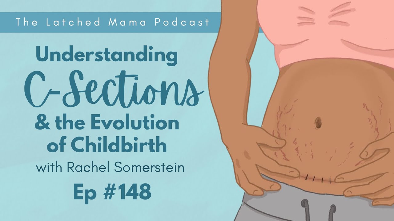 C-Sections and the Evolution of Childbirth with Rachel Somerstein | The ...