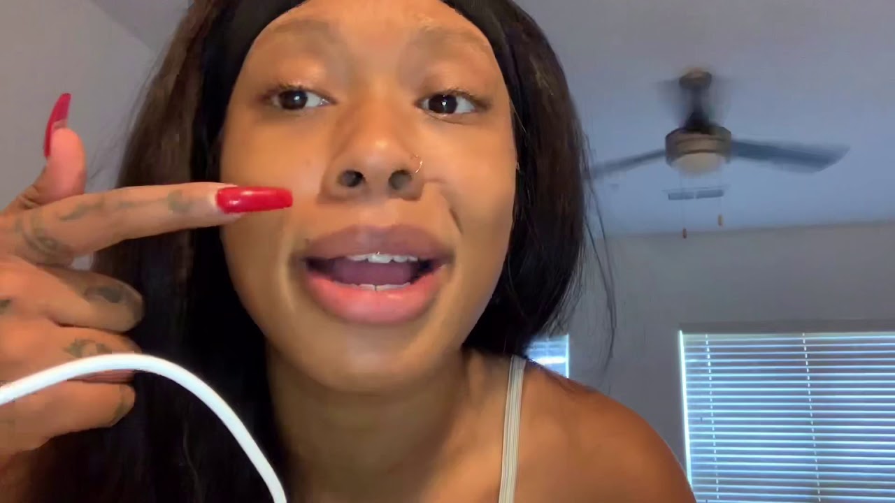 HOW DOES LUL BENZIE SKIN STAY SO CLEAR !!!! - YouTube