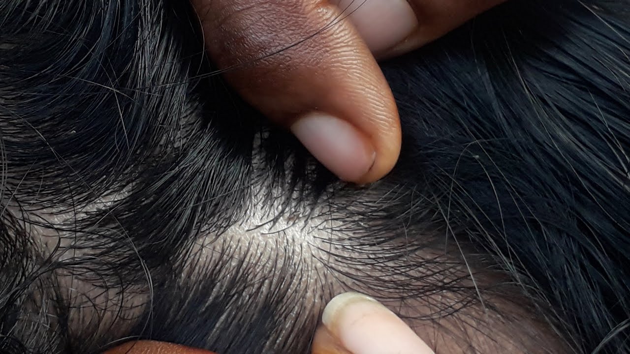 Nitpicking by silky black hair with her mother hands/Real sounds/heavy ...