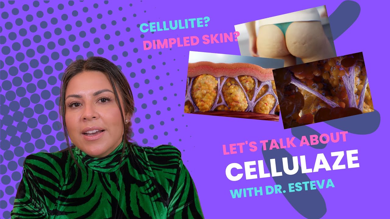 Let's talk about Cellulite | Dr. Soraya Esteva - YouTube