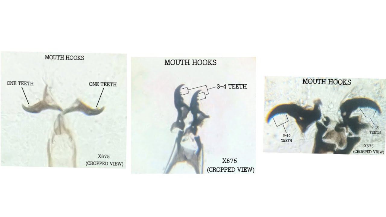 FIRST, SECOND & THIRD INSTAR LARVA OF FRUIT FLY (Drosophila sp.) UNDER ...