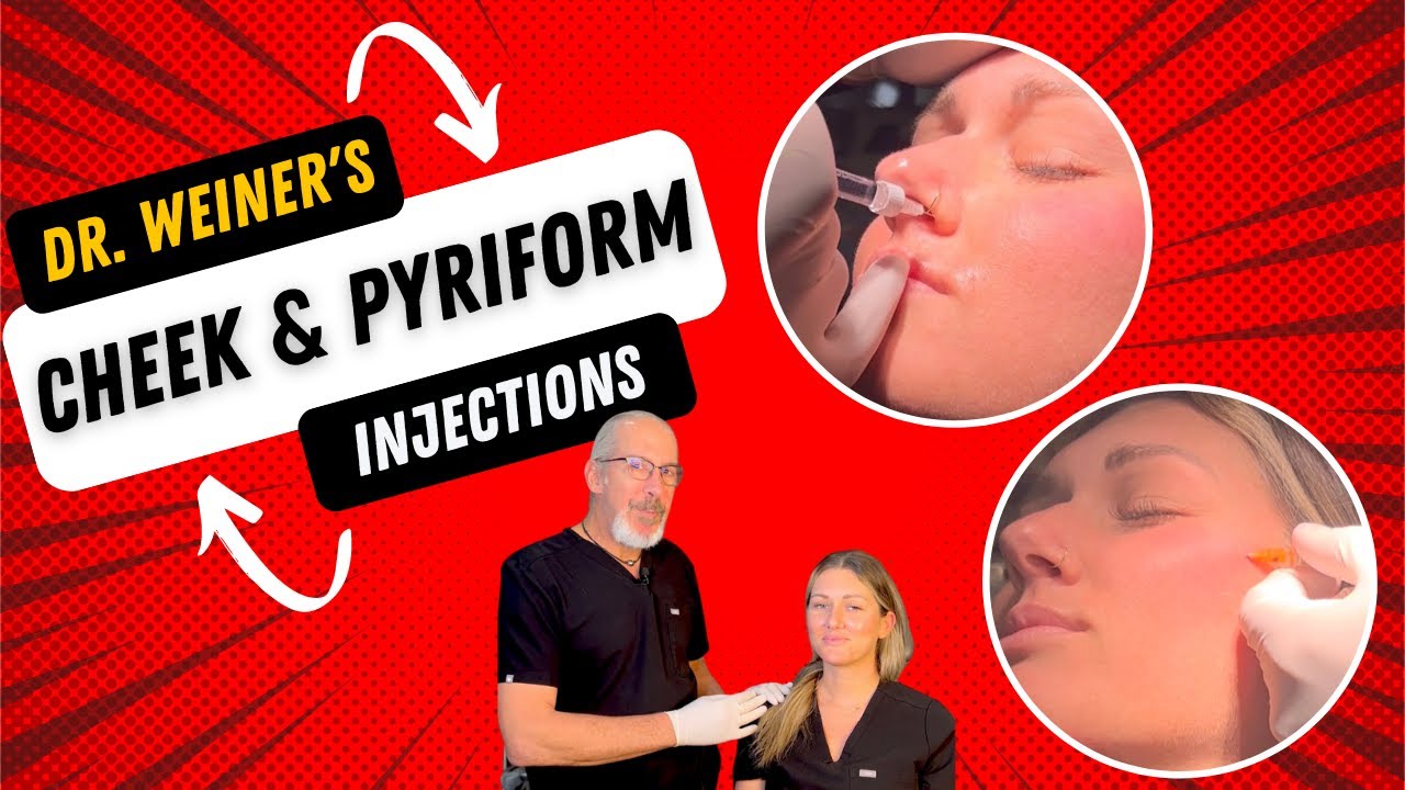 2 Of Dr. Steven F. Weiner's Most Popular Areas To Inject - Prezygomatic ...