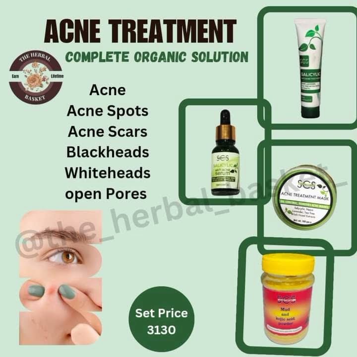 complete acne set available now || SCS || acne treatment || success ...