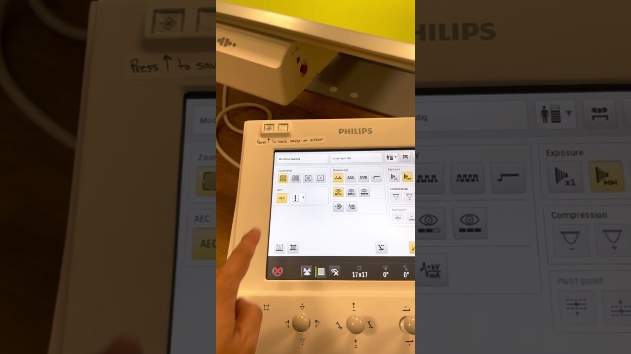Philips CombiDiagnost R90 Fluoroscopy radiologist’s interface primer 7 ...