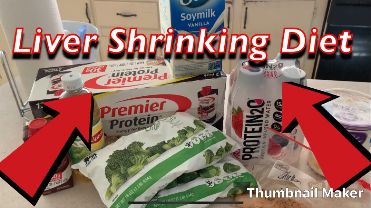 VSG CHRONICLES | Day 1: Liver Shrinking Diet - YouTube