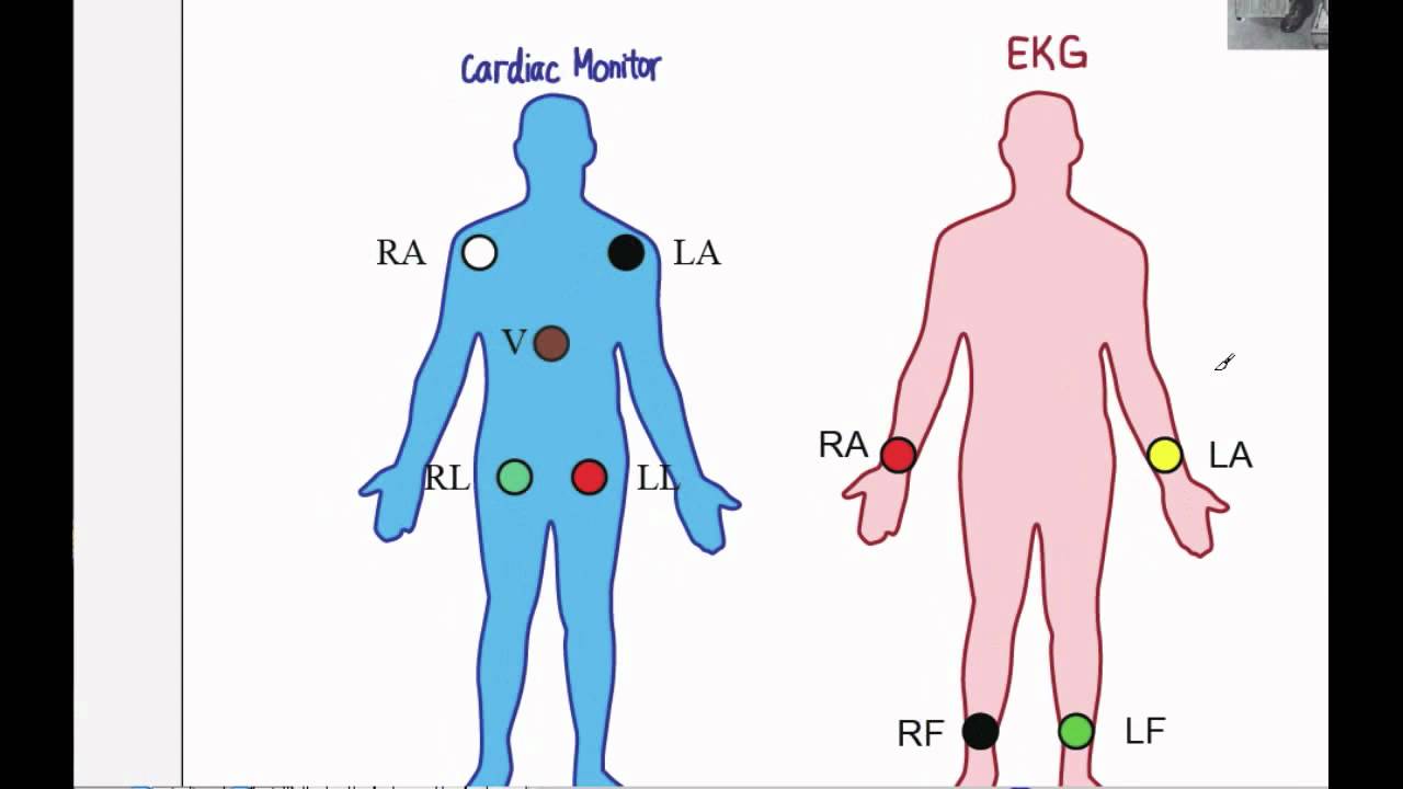 EKG 01 How To Perform An EKG YouTube EKG 01 How To Perform An EKG YouTube