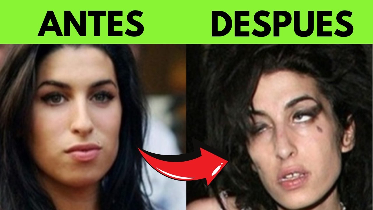 25 Famosos que Quedaron Desfigurados por las Drogas – Antes y Después ...