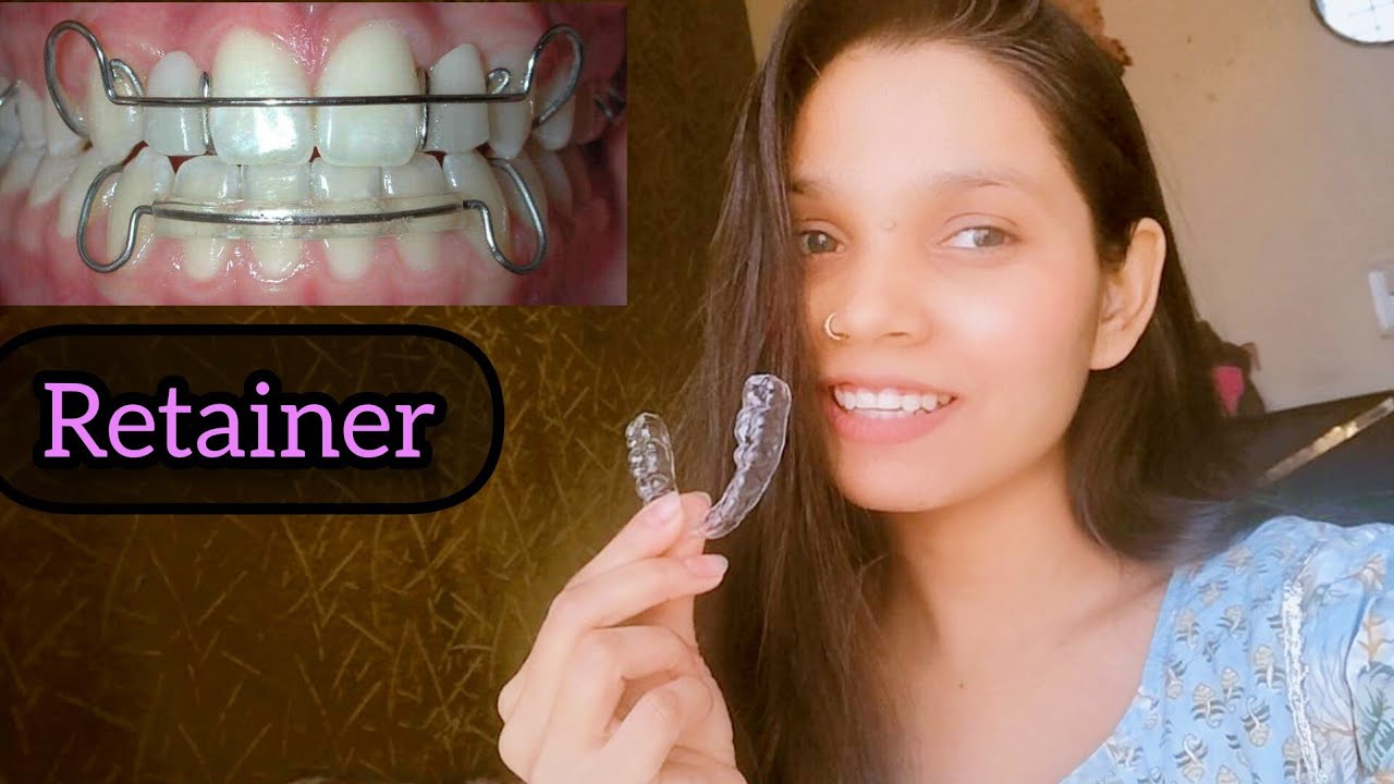 retainer kaise use kerte hai | retainer कैसे पहनते है | retainer after ...