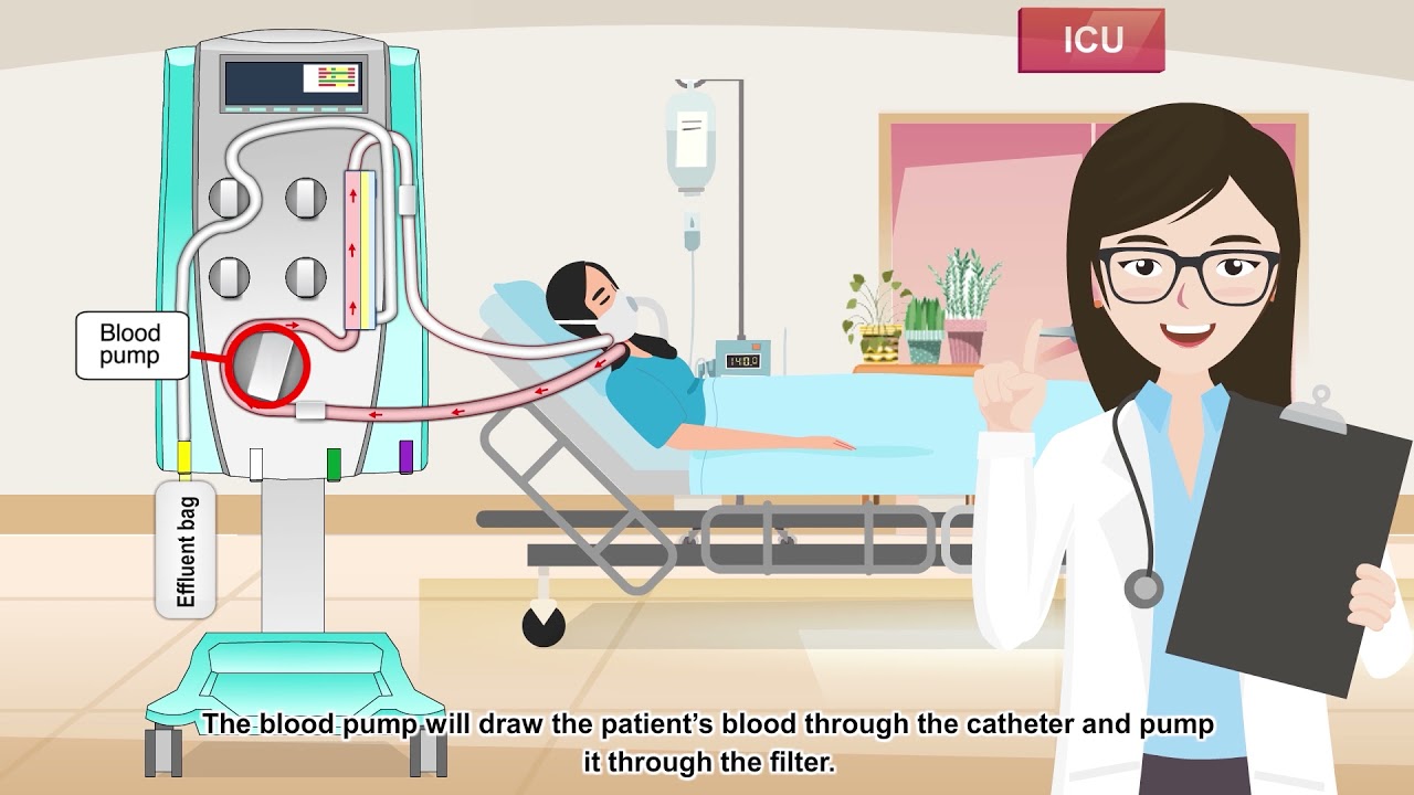 Prismaflex CRRT SCUF Modality - YouTube