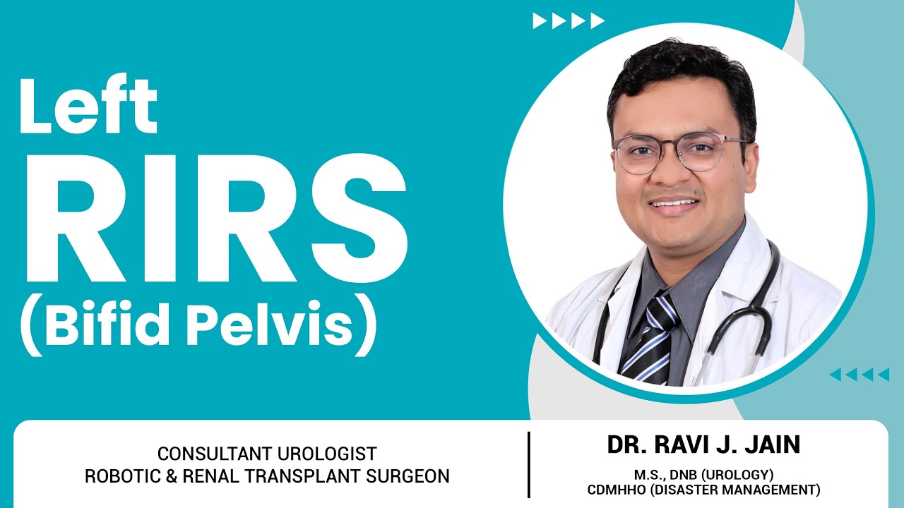 Left RIRS (Bifid Pelvis) : Dr. Ravi Jain : Consultant Urologist & Renal ...