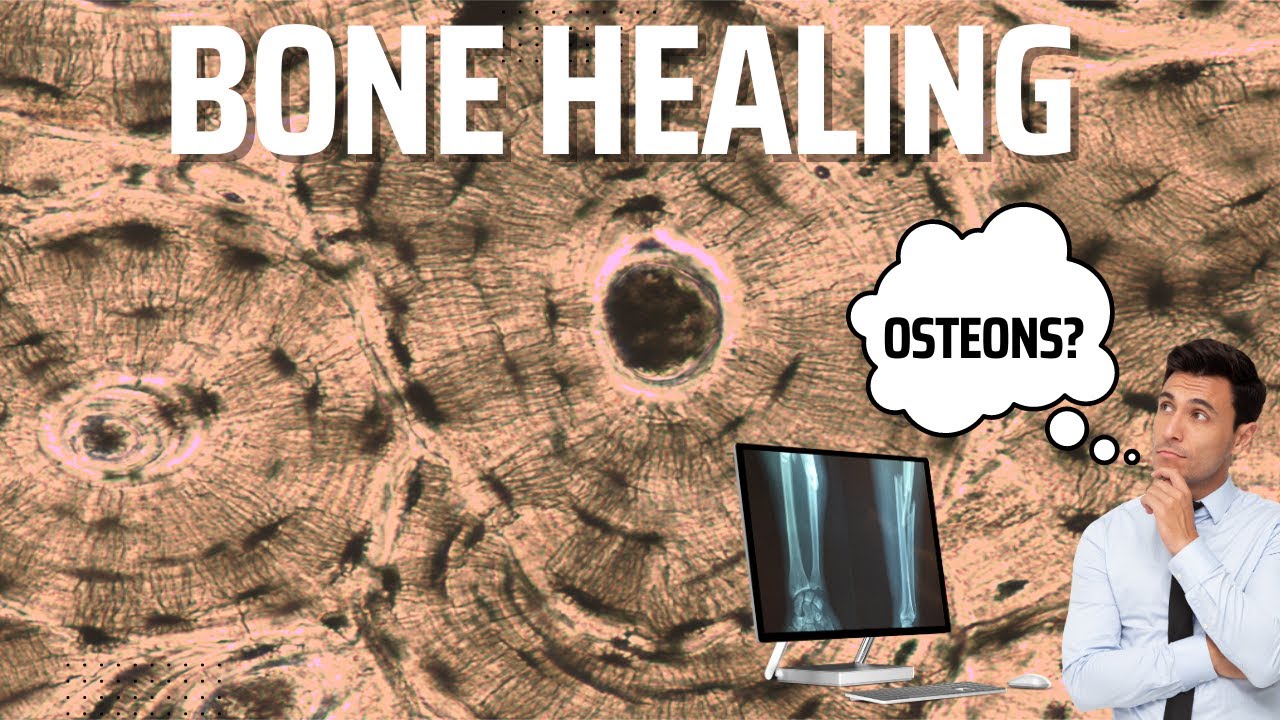How Your Bones Heal | Bone Biology Made Simple - YouTube