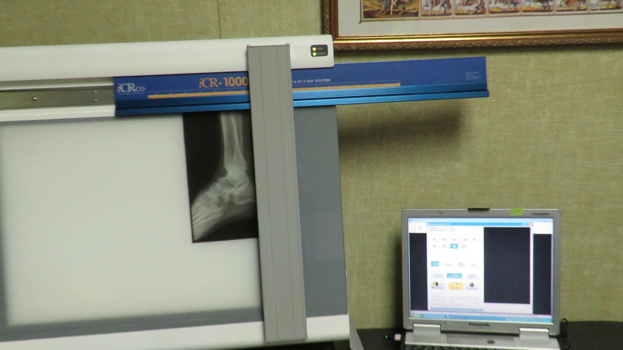 iCRco iCR-1000SL LARGE FORMAT X-RAY Film Digitizer 4sale on ebay ...