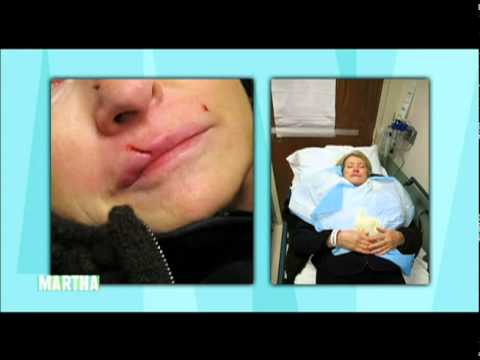 Martha's Split Lip⎢Martha Stewart - YouTube