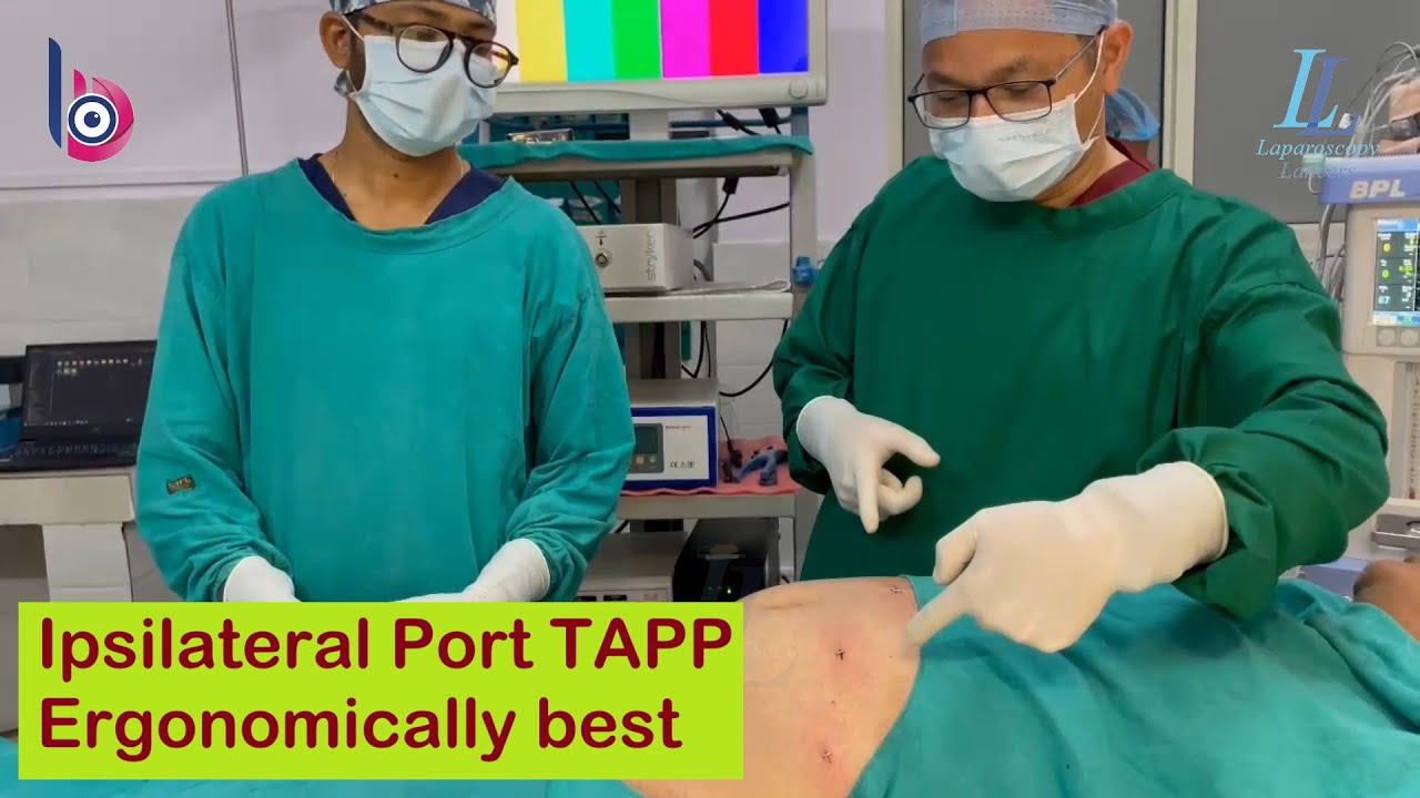 Ipsilateral ports for TAPP under SA - Ergonomic benefits - YouTube