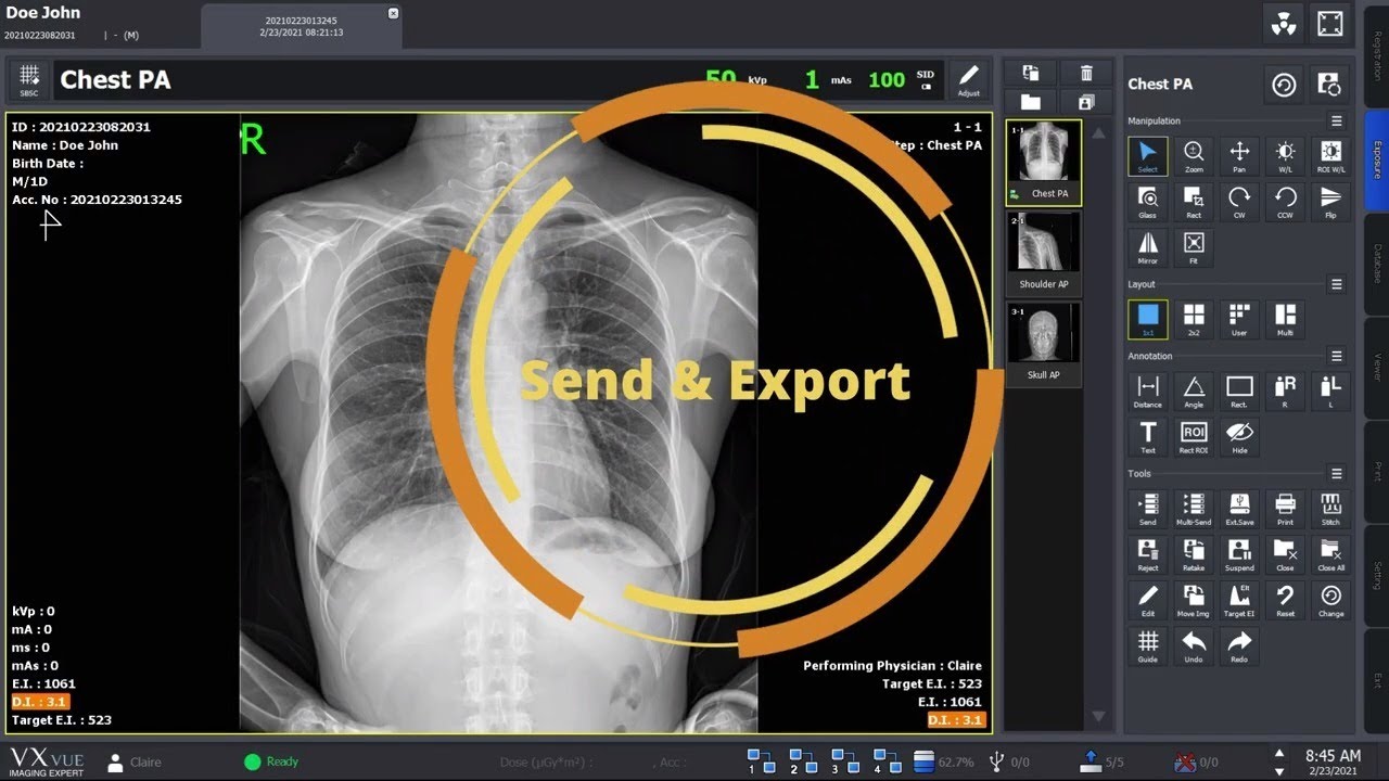 VXvue Quick Guide - Send and Export X ray Image - YouTube