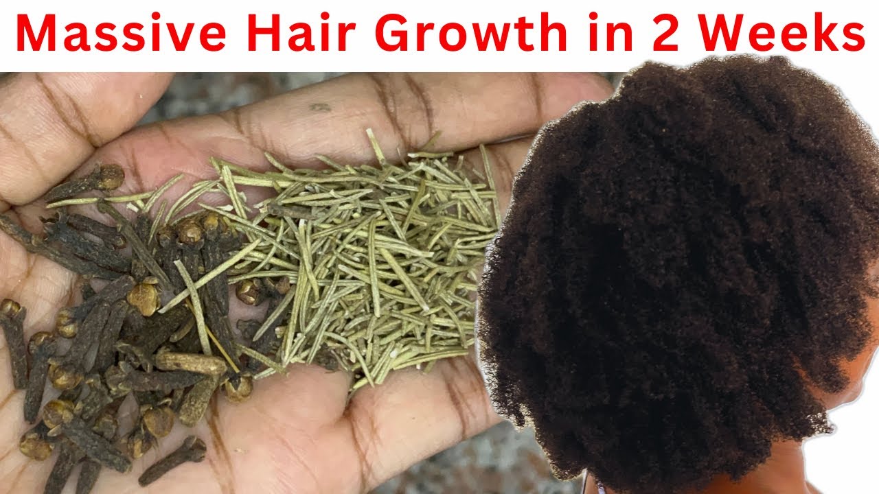 Transform Your Hair in 2 Weeks | Cloves and Rosemary Water for Massive ...
