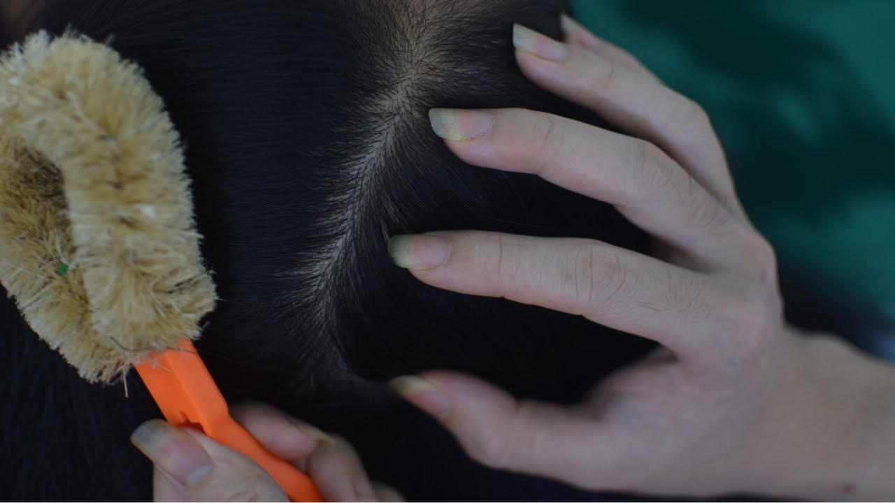 ASMR Aggressive Scalp Scratching, Scalp Massage On Real Person ...