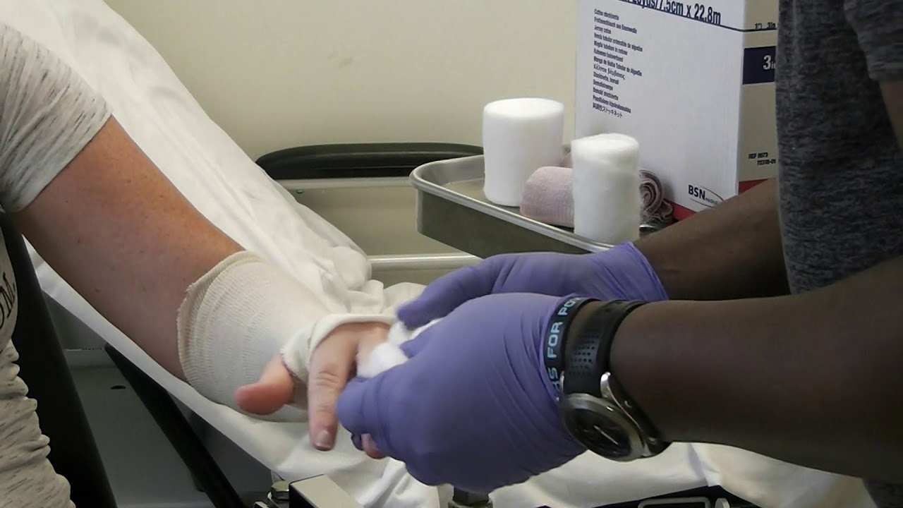 ULNAR GUTTER - YouTube