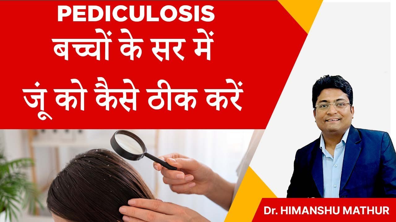 Pediculosis - Head lice treatment by Dr Himanshu Mathur, Gauri Hospital ...