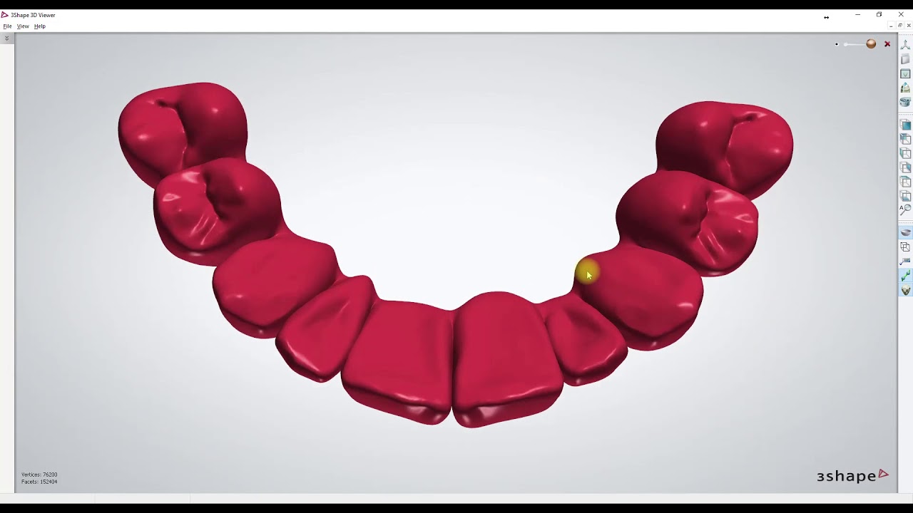 3Shape DentalSystem. How to use virtual WaxUp - YouTube