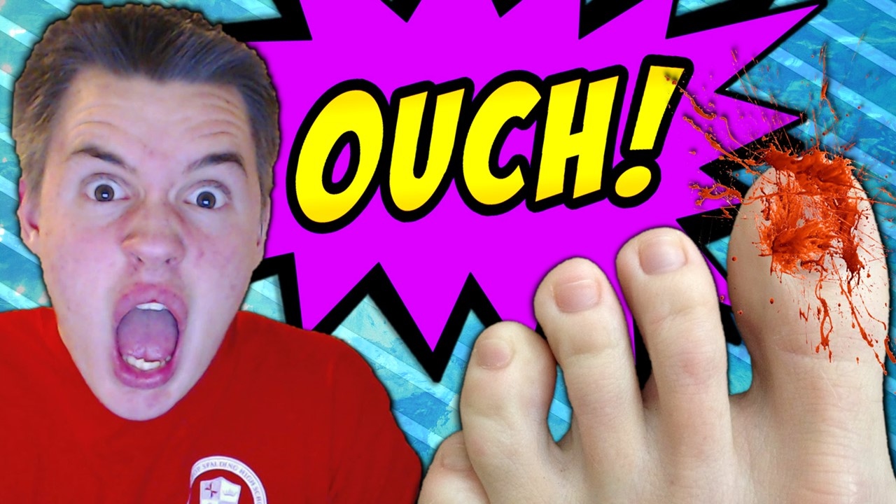My Entire Toe Nail Came Off!!! (A Cod Story) - YouTube