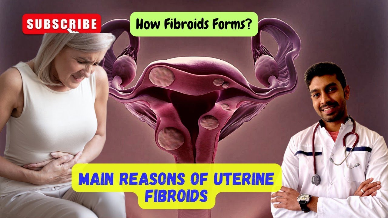 Main Reasons Of Fibroids in Uterus || Must Watch - YouTube