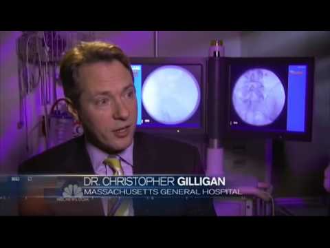 Back pain spinal cord stimulator Chris Gilligan MD MBA - YouTube