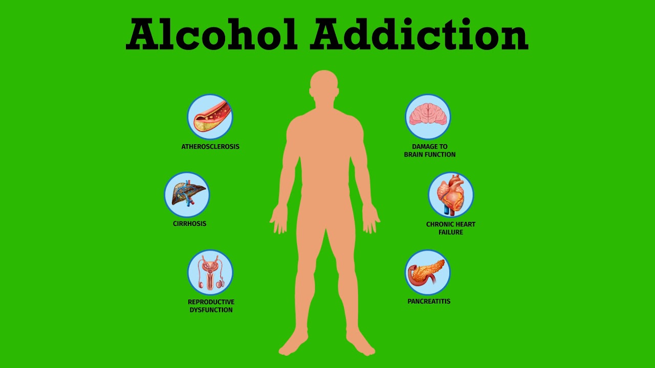 Alcohol Addiction Animation - Green Screen | Animation Video | After ...