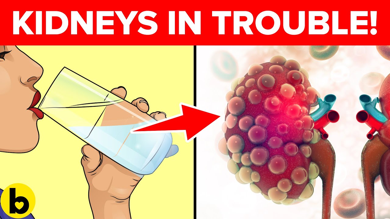 7 Innocent Mistakes That Get Your Kidneys in Big Trouble - YouTube