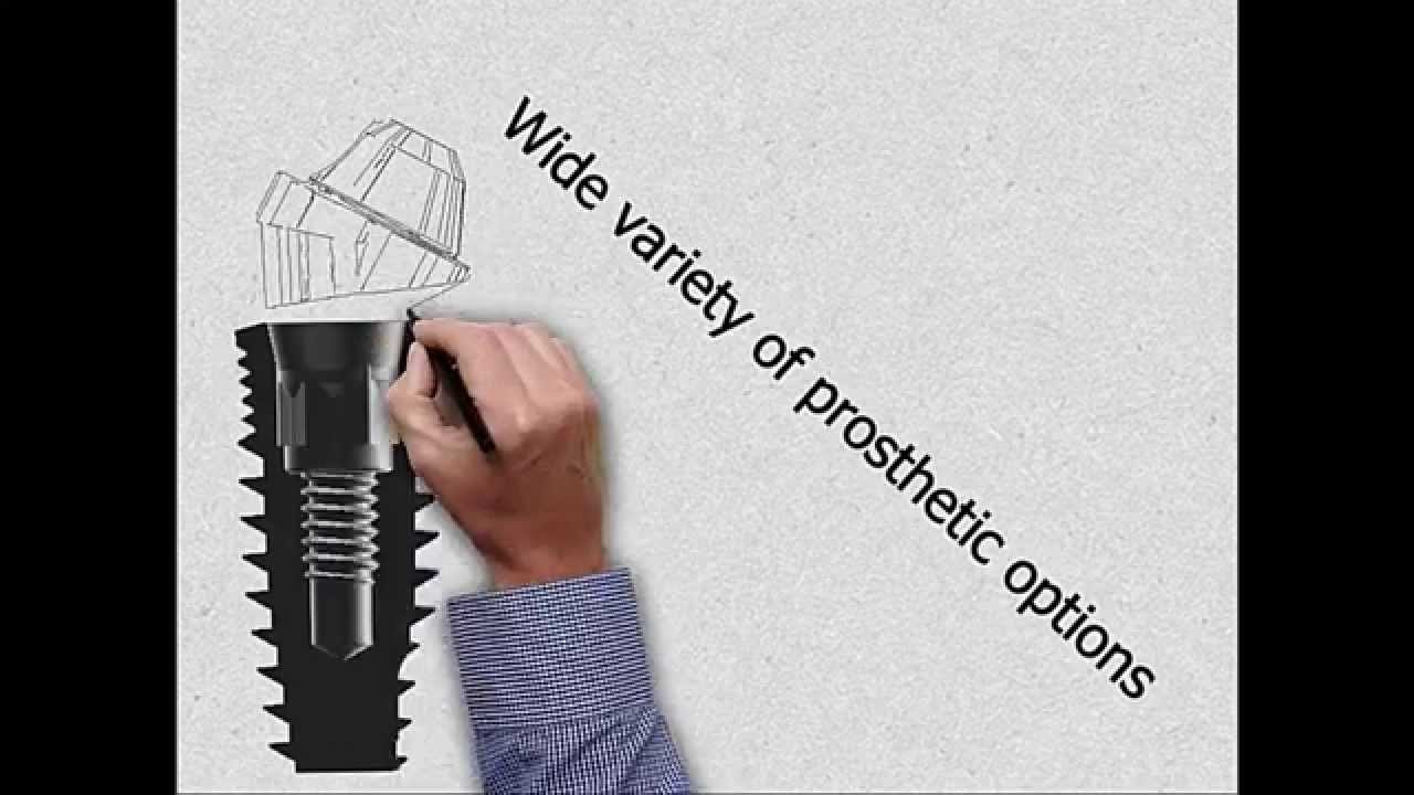 Bio Max Implants Video - YouTube