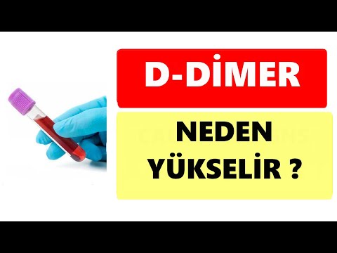 D-DİMER YÜKSEK ÇIKTI, BU NE DEMEK ?