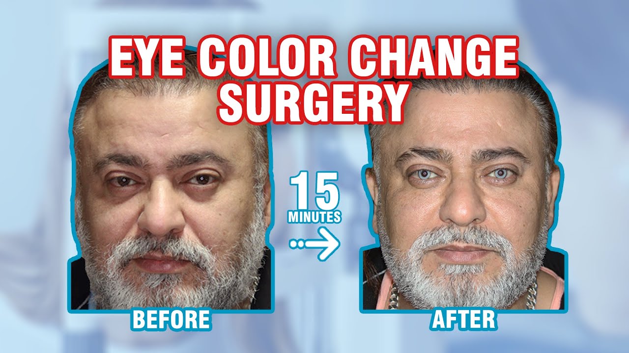 eye color Change of the famous Lebanese singer - YouTube