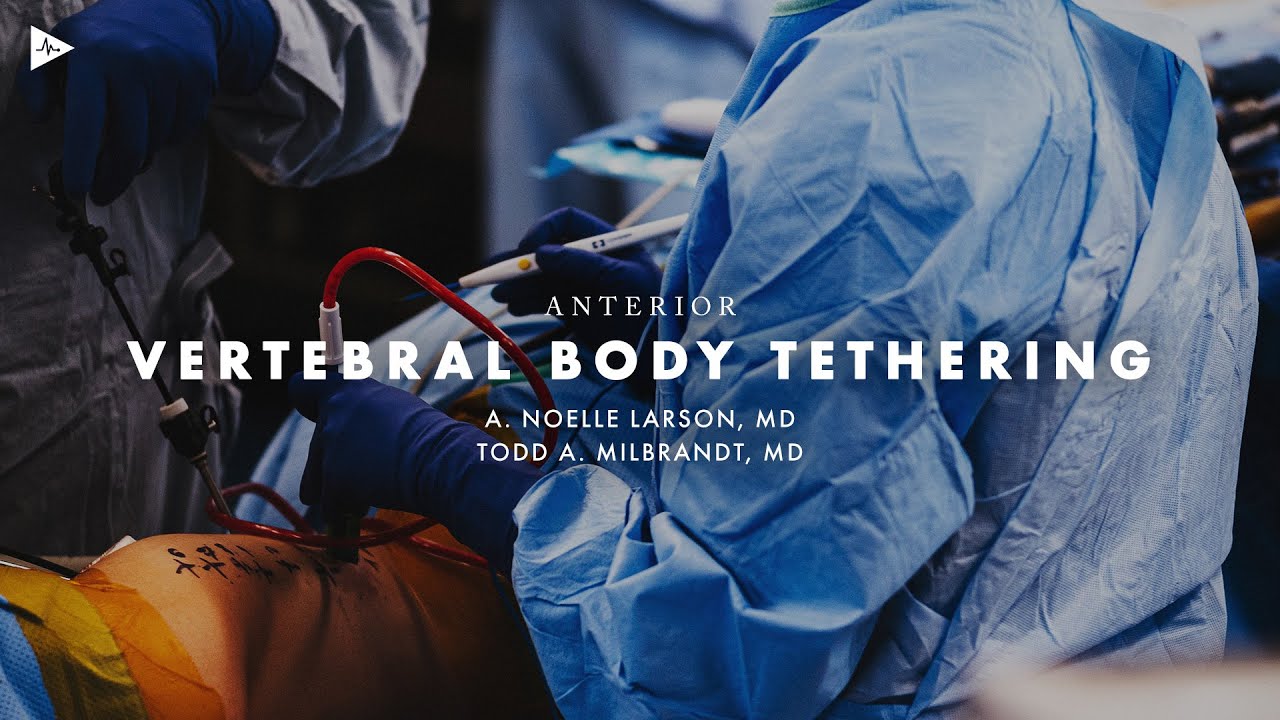 Anterior Vertebral Body Tethering by A. Noelle Larson, MD | Preview ...