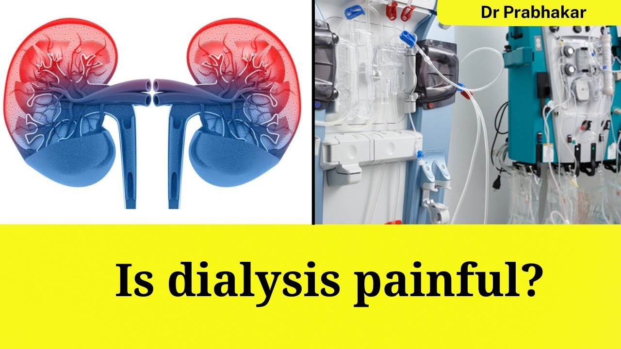 Is dialysis painful? - YouTube