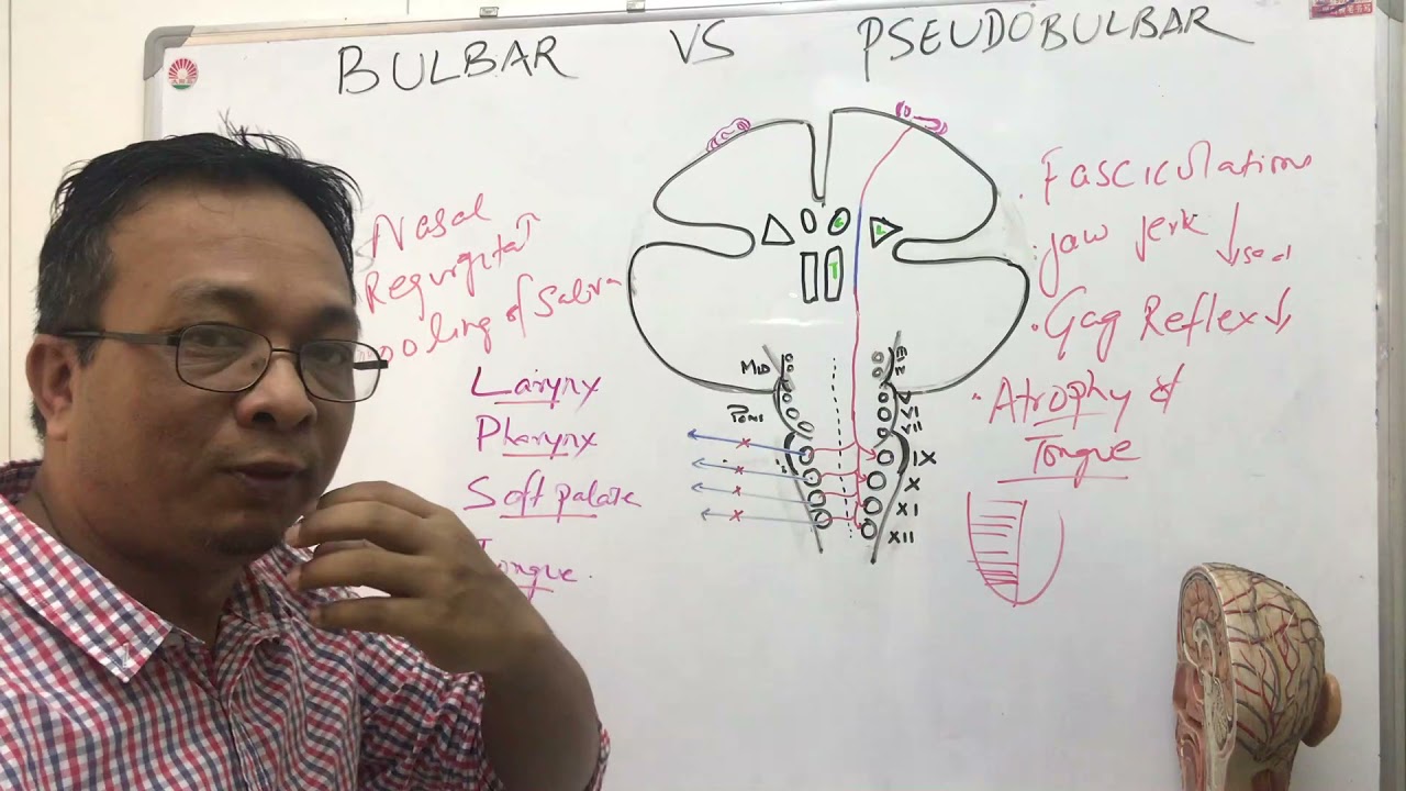 bulbar palsy vs pseudobulbar palsy - YouTube