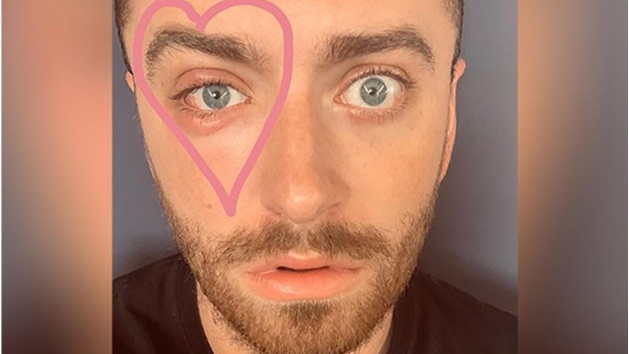 Sam Smith shows off his new look after undergoing eye operation to ...