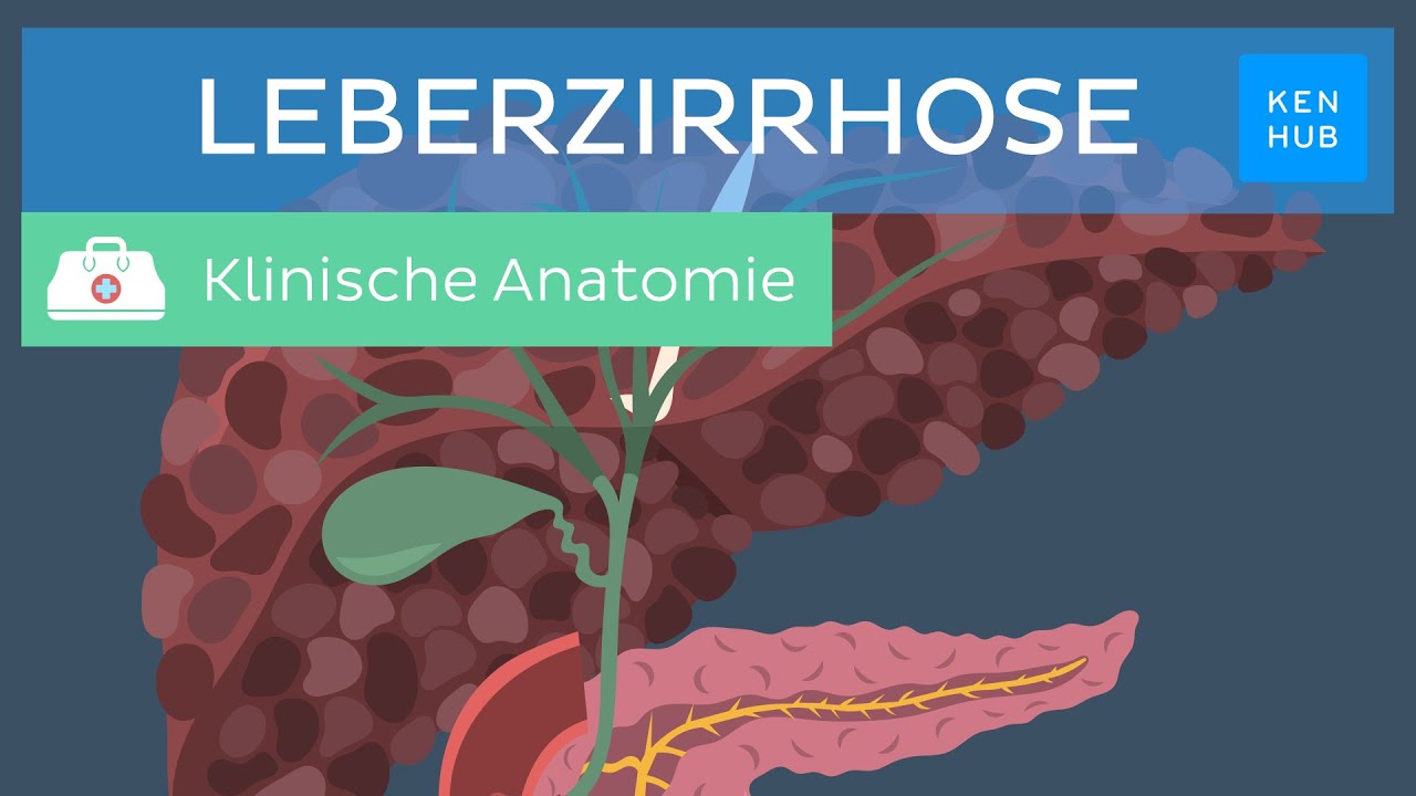 Leberzirrhose: Ursachen, Symptome, Diagnose, Behandlung | Kenhub - YouTube