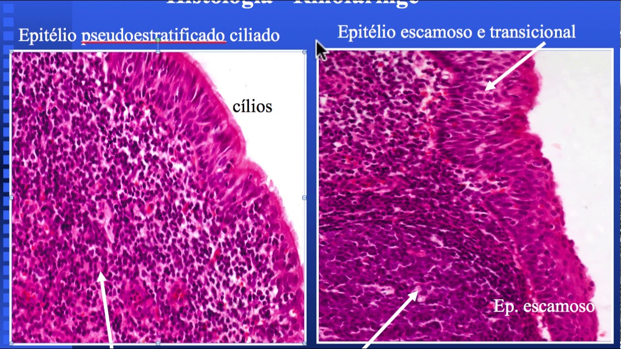 RINOFARINGE HISTOLOGIA - YouTube