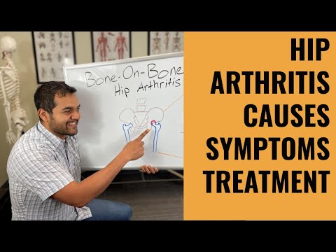Everything You Need To Know About Bone On Bone Hip Arthritis