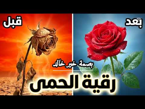 Ateş tedavisi için güçlü İslami rukye (çeviri) | Şeyh Halid Omri
